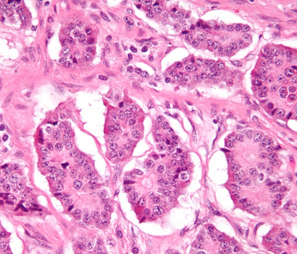 Types of cancer - Group Loop